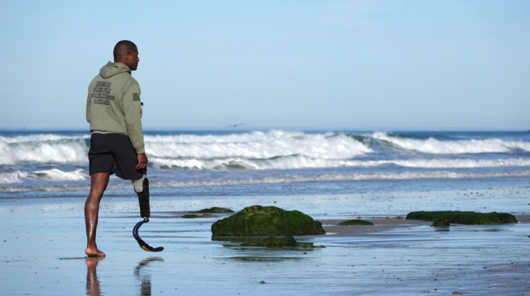 How Modern Prosthetics Transform Rehabilitation Practices - Prothotic ...